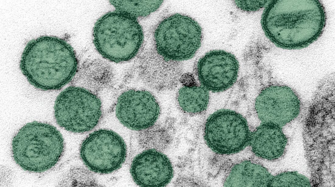 Hantavirus Outbreak Kills Three Aboard Cruise Ship; Two Sick Crew ...